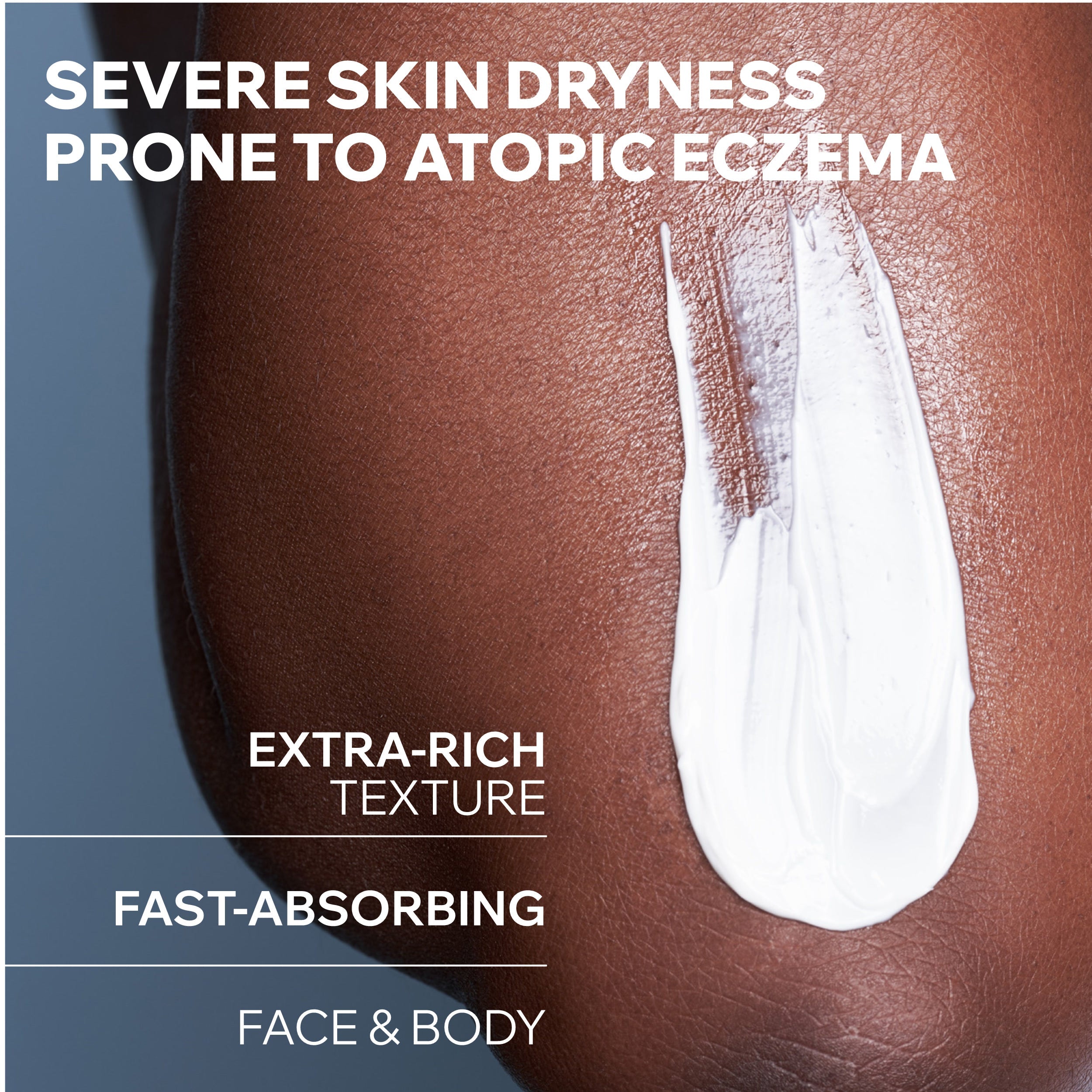 URIAGE XEMOSE C8+ Soothing Lipid-Replenishing Treatment 200ml – Goods